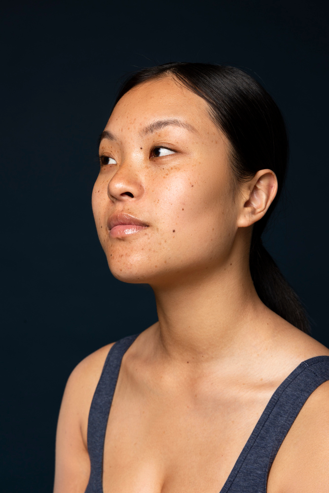 Mole Removal - Atlas Pacific